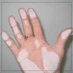 Common Paint Problems - CPCA